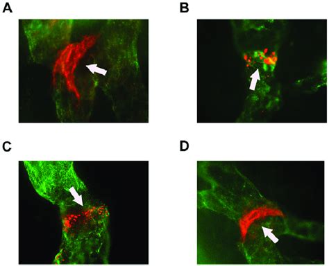 Morphologically Distinct Stages Of Lymphatic Valve Formation In Download Scientific Diagram