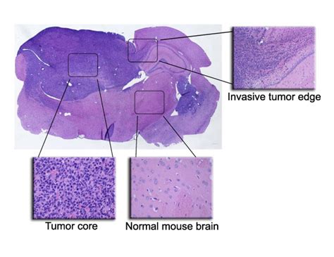 Three Geographic Tumor Regions Targeted For Rna Isolation Using Download Scientific Diagram