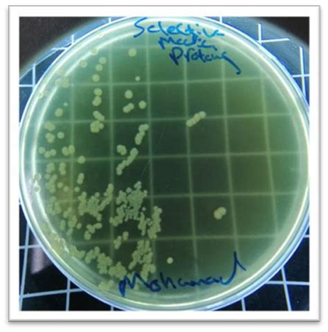 Proteus Spp 2 Proteus Spp And Klebsiella Spp Resistance Data For