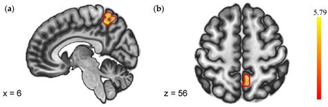 The Impact Of Sleep Deprivation On Brain Networks In Response To Social