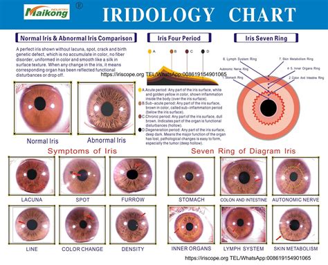 Comprehensive Guide To Iiridology Iris Diagnosis Deto Maikong