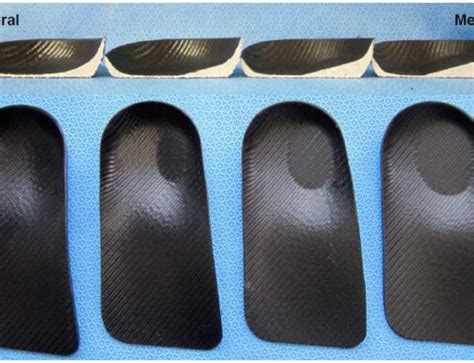 Medial Flange And Orthotics Motion X