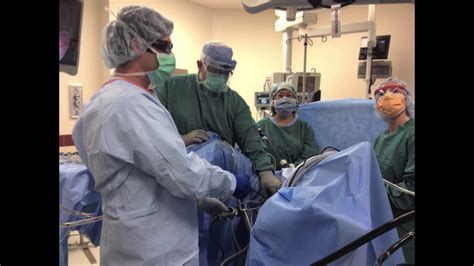 Diverticulitis Laparoscopic Assisted Trans Anal Minimally Invasive