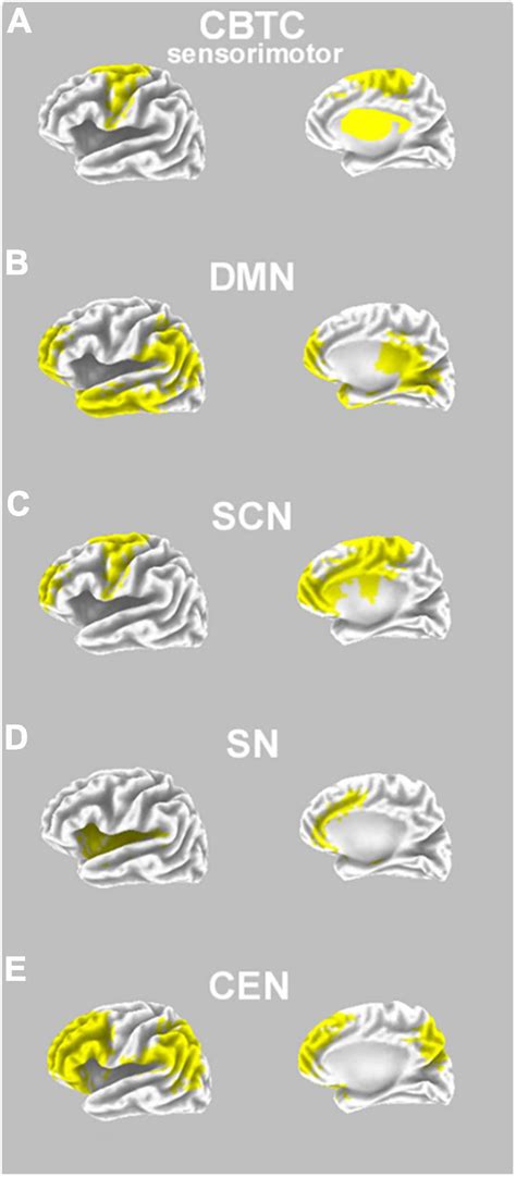 Psychedelics In Developmental Stuttering Cenexel