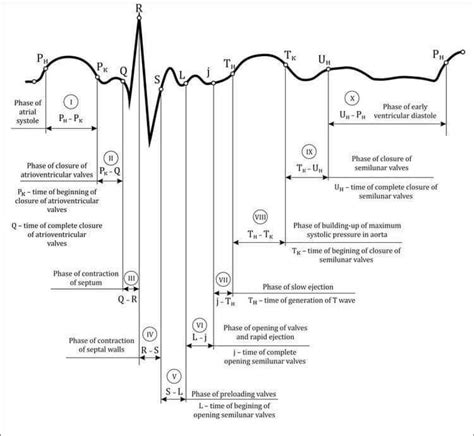 Which Type Of Atrioventricular Block Best Describes This Rhythm