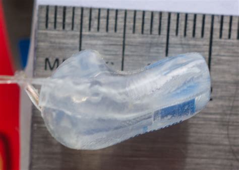 Best Earmold Impression Method Open Mouth Closed Mouth Or Relaxed