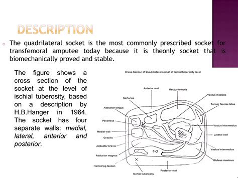 Clinical Consideration Of Quadrilateral Socket 2000 Pdf