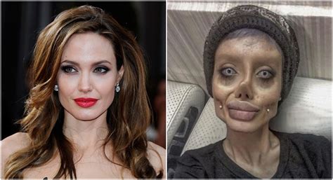 안젤리나 졸리 닮기 위해 50차례 성형한 소녀의 진실동영상 포스트쉐어