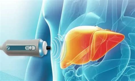 Benefits Of Fibroscan For Liver Disease Diagnosis Dr Bhate