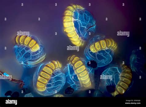 Fern Sporangia Fluorescent Image Uv Excitation Microscopic Image