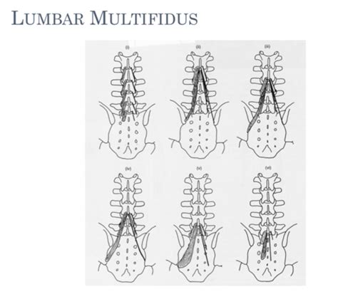 Spinal Stabilization Pm Exam 2 Flashcards Quizlet