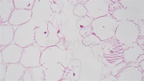 Lilium Matuer Anther In Transversal Section Under Microscope 40x On