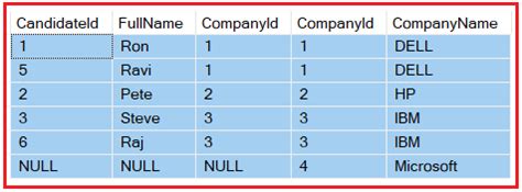 Right Outer Join In SQL Server With Examples Dot Net Tutorials