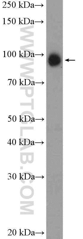 Usp5 Antibody 15158 1 Ap Proteintech