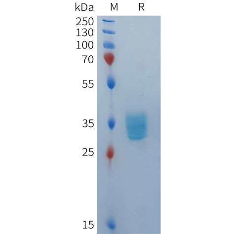 Recombinant Human Bcma42 54 Protein With C Terminal Mouse Fc Tag