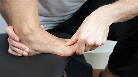 Windlass Test Plantar Fasciitis Assessment Heel Pain Exam