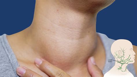 Head And Neck Surgeries In Rawalpindi Khan Ent And Medical Care Center