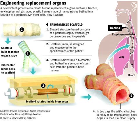 Her Own Stem Cells Used To Build Tot A Windpipe