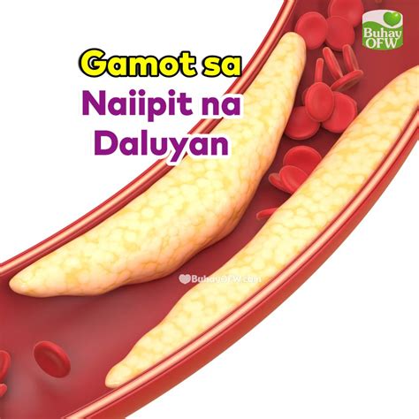 Gulay Sa Baradong Ugat Ng Dugo Baka Biglang Bumara Ang Ugat Ng