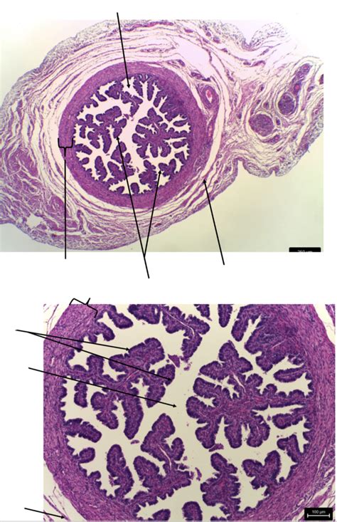 Uterinefallopian Tube Microscope Slides Diagram Quizlet