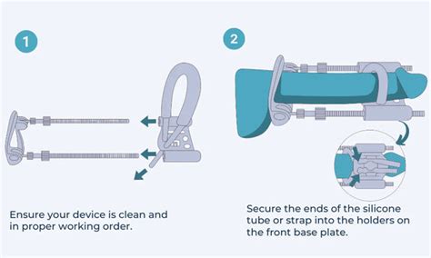 Penis Traction Device Benefits Usage Guide And Proven Results
