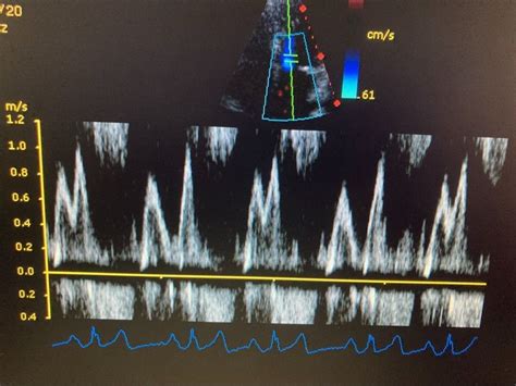 Omar Salem On Linkedin I See A Pattern Mv Pw