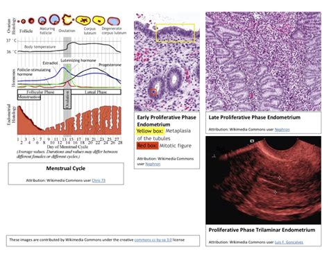 Proliferative Phase Endometrium Jaypeedigital Ebook Reader