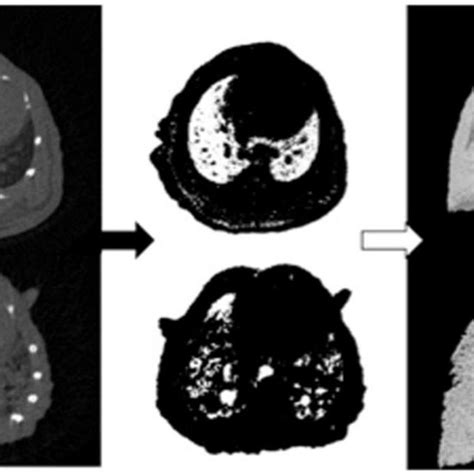 Dual Energy Micro Ct Material Decomposition A In Vitro Phantom Download Scientific Diagram