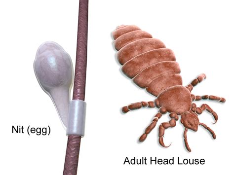 Human Lice Eggs
