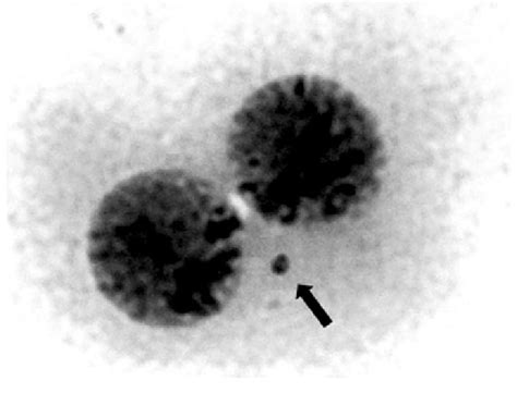 Binucleated Cell With A Micronucleus Marked By An Arrow Download Scientific Diagram