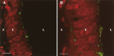 Interactions Of N Gonorrhoeae With Human Ft A Pil Ϫ Opa ϩ Gonococci