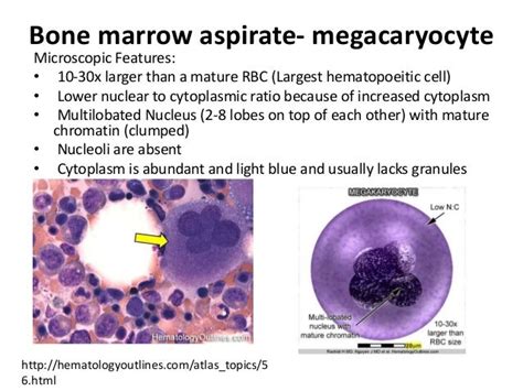 Immune Thrombocytopenic