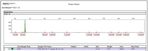 Electropherogram Of Multiplex Reaction Of Amplification The Visible Download Scientific