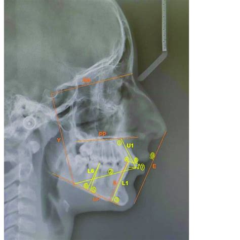 The Angular And Linear Skeletal Measurements Download Scientific Diagram