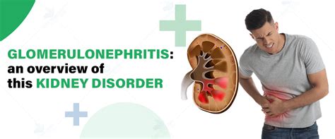 Acute Glomerulonephritis Hypocomplementemia At Diagnosis Of