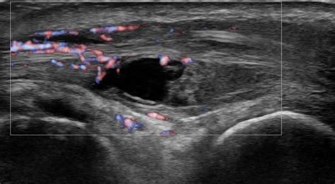Musculoskeletal Joints And Tendons 63 Wrist And Carpus Case 633