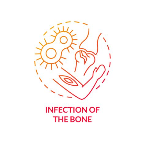 Infection Of Bone Red Gradient Concept Icon Common Joint Condition