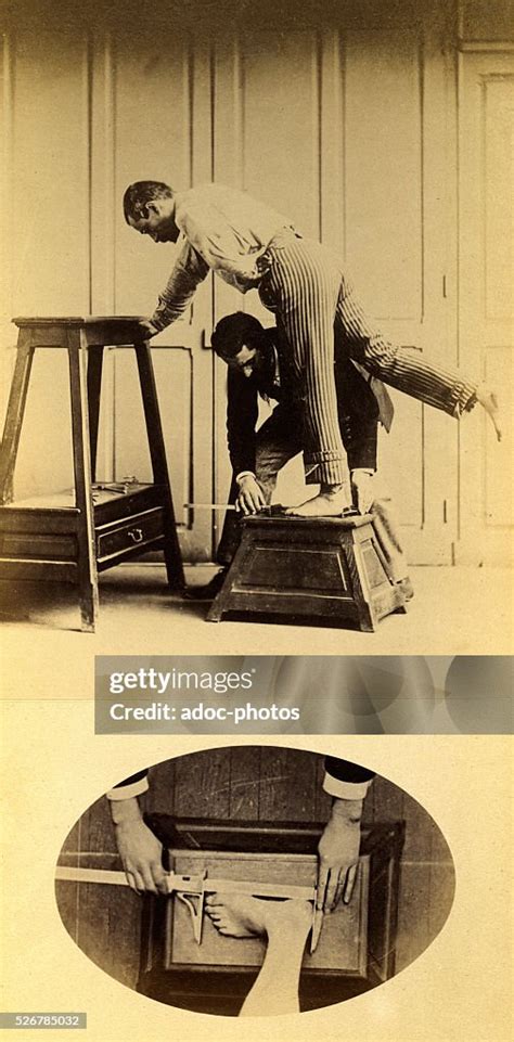 Anthropometric System Of Alphonse Bertillon Measurement Of The Foot News Photo Getty Images