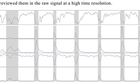 The Five Feature Signals That Have Been Chosen For Bs Classification Download Scientific