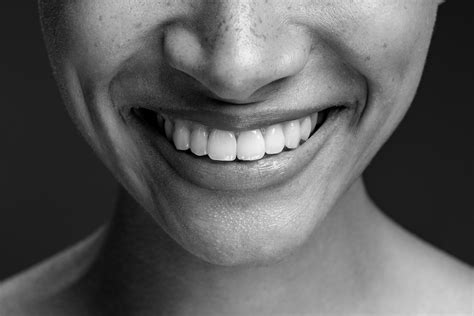 Diseño De Sonrisa Digital En Sevilla Smile Design Avanzado On