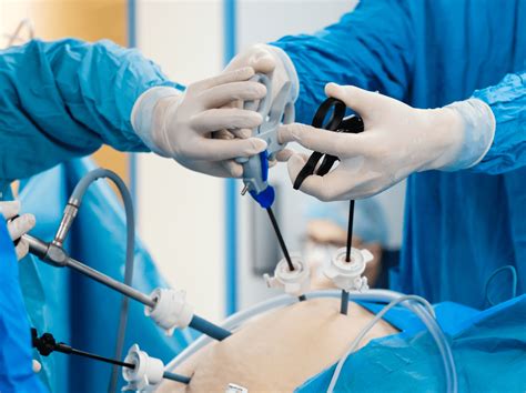 Pólipos De Colon Cirugía De Colon Dra Rosángela Obregón