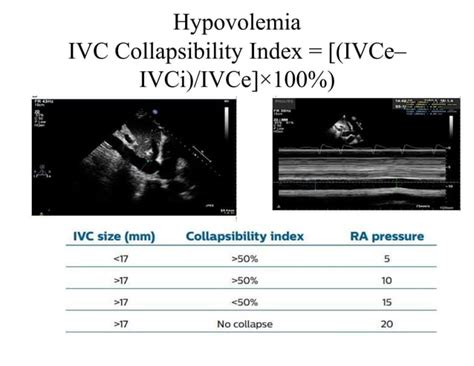 Basics Of Tte And Tee Trans Esophageal Echopptx