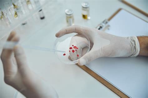 Low White Cell Count And Cancer