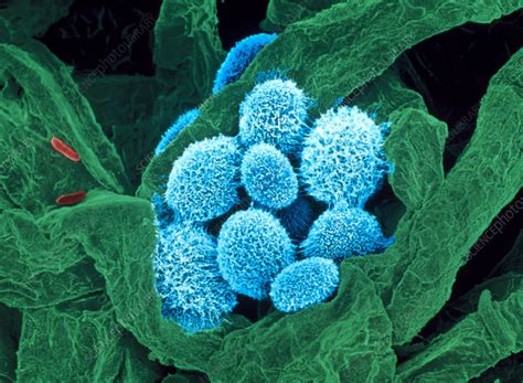 Mould On Leaf Sem Stock Image B2500996 Science Photo Library