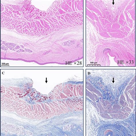 Diagrams Of Measurements A Tibia Length And Superposition Of Rod