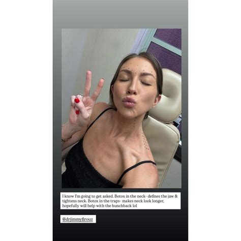 Stassi Schroeder Explains Botox For Hunchback And Jawline Us Weekly