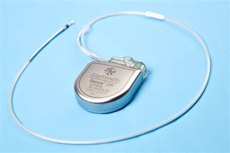 What Is A Defibrillator Implant At Lucas Cade Blog