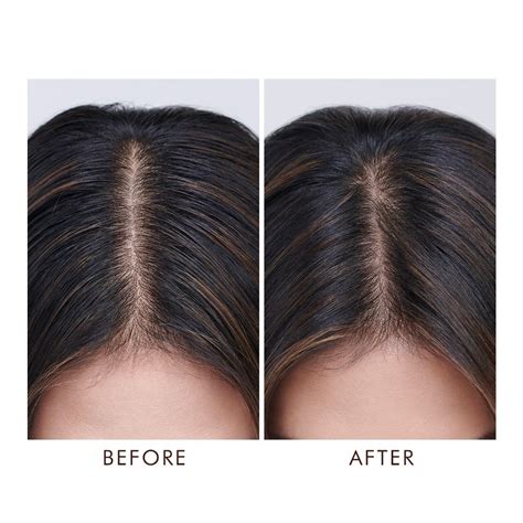 Средство для жирной кожи головы – Moroccanoil