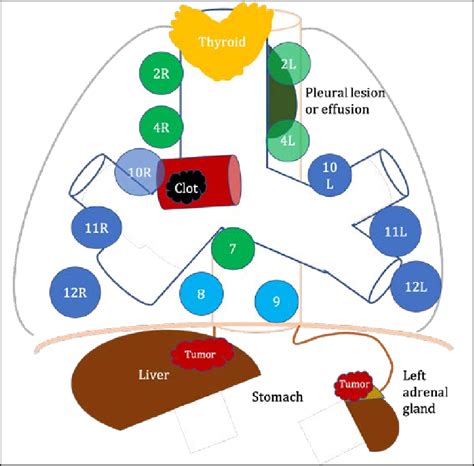 Sites Available To Perform Ebus Tbna Blue Circles Represent The Main Download Scientific
