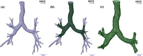 Upper Airway Geometry Anterior View Generated From Ct Image
